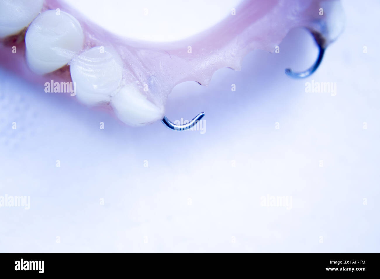 Removable partial denture metal and plastic dental false teeth ...