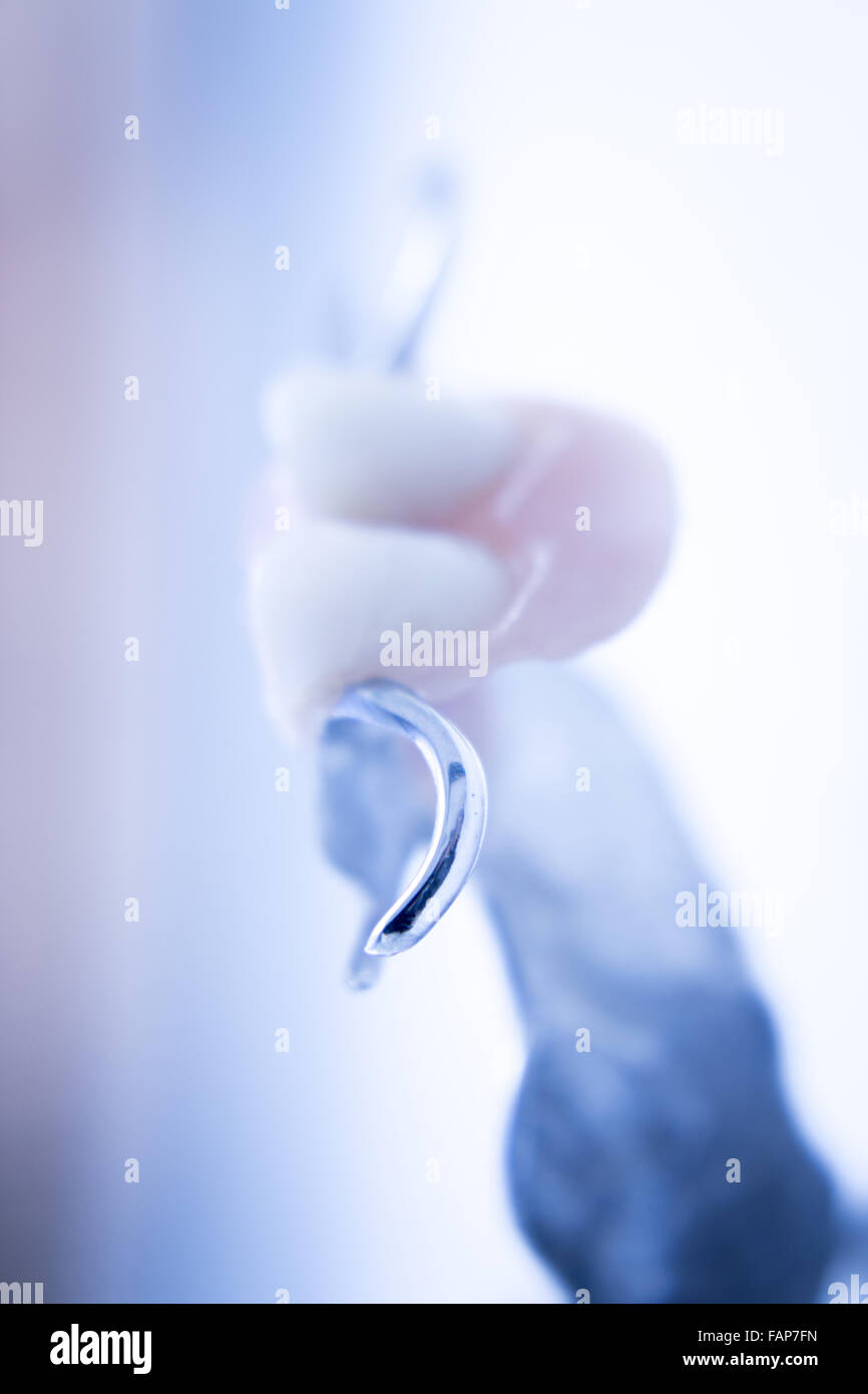 Removable partial denture metal and plastic dental false teeth ...