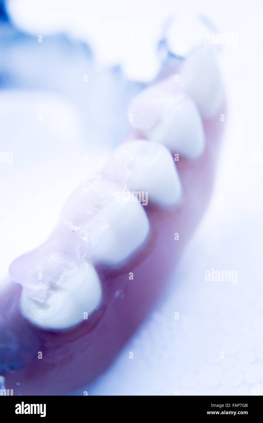 Removable partial denture metal and plastic dental false teeth ...