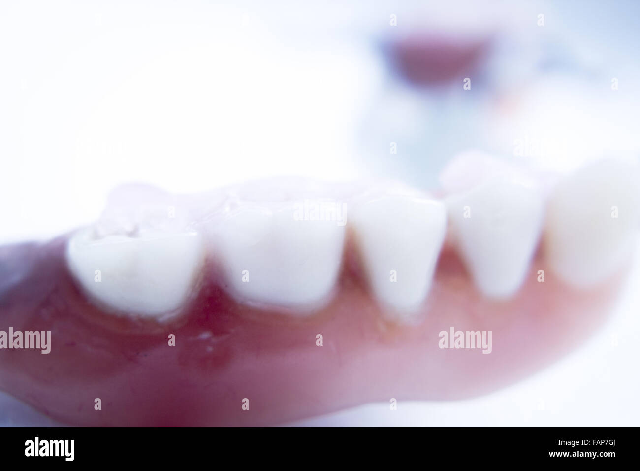 Removable partial denture metal and plastic dental false teeth ...