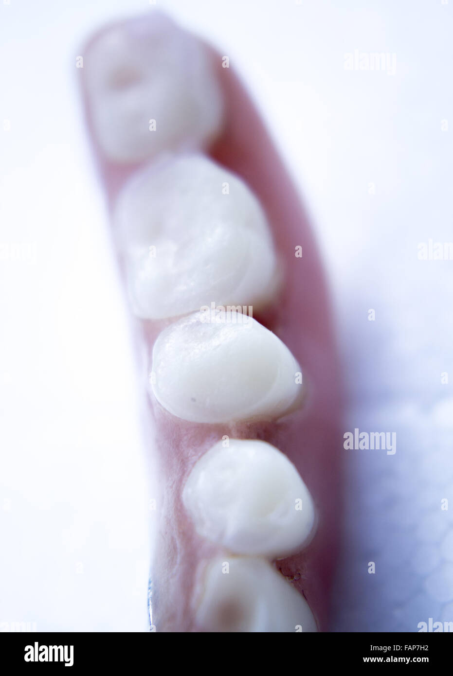 Removable partial denture metal and plastic dental false teeth ...