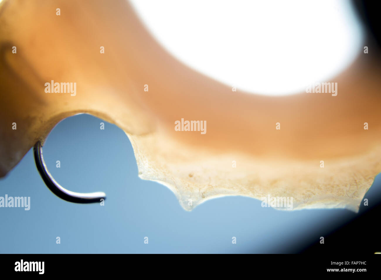 Removable partial denture metal and plastic dental false teeth ...