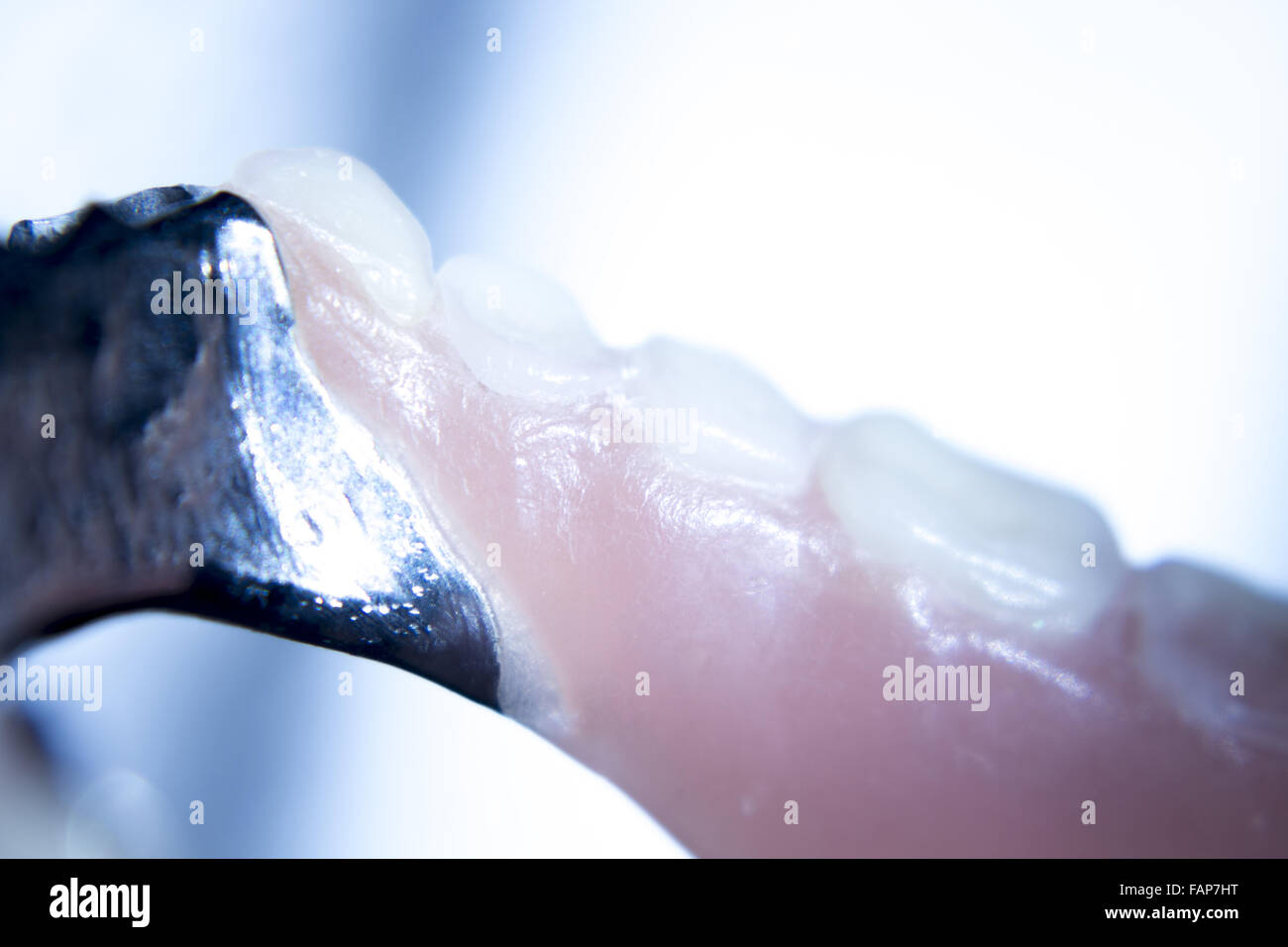 Removable partial denture metal and plastic dental false teeth ...