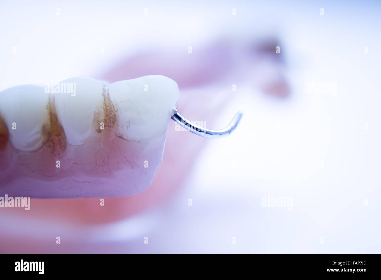 Removable partial denture metal and plastic dental false teeth ...