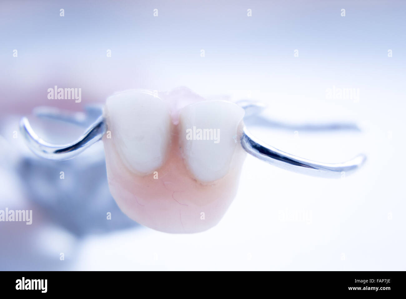 Removable partial denture metal and plastic dental false teeth ...