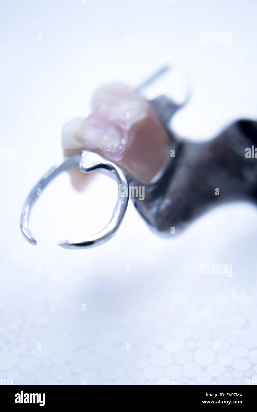 Removable partial denture metal and plastic dental false teeth ...