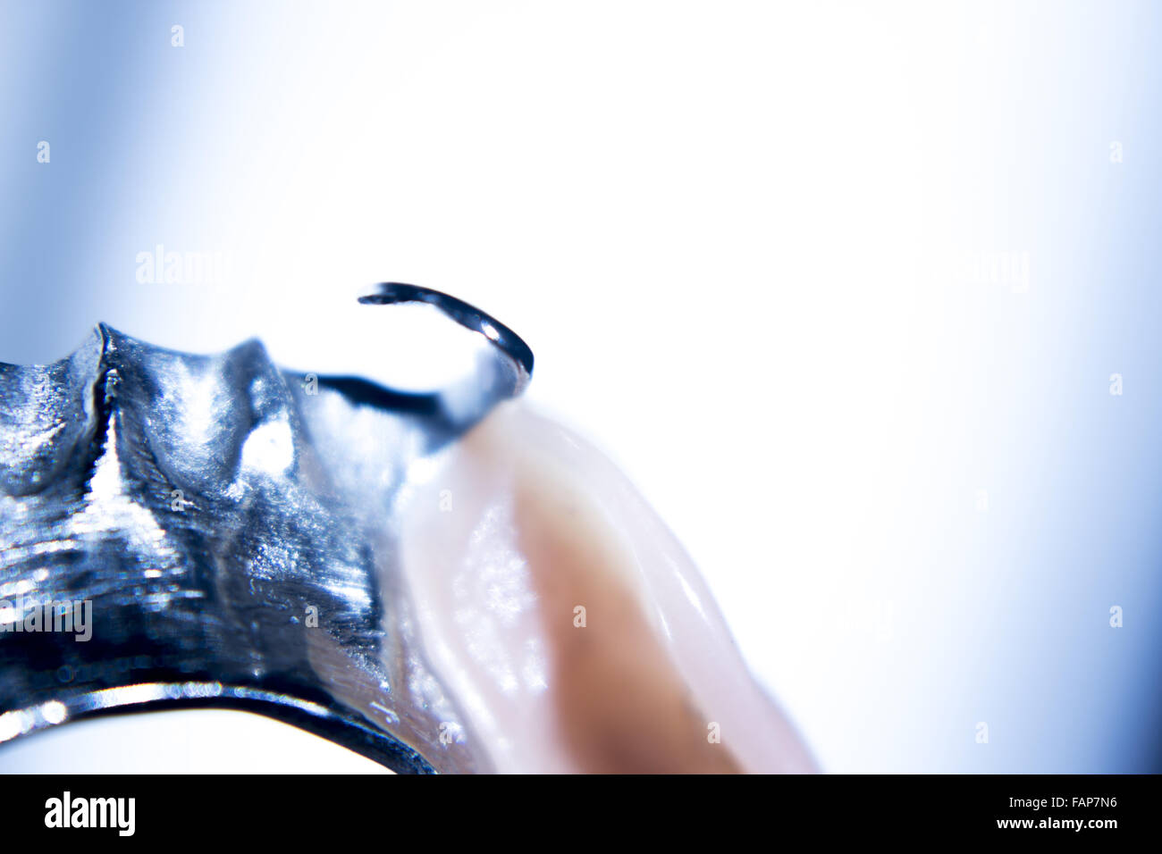 Removable partial denture metal and plastic dental false teeth ...