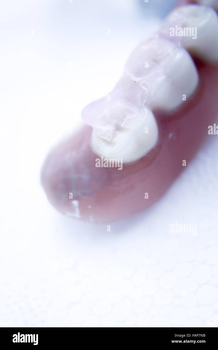 Removable partial denture metal and plastic dental false teeth ...