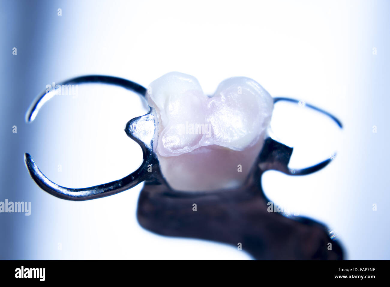 Removable partial denture metal and plastic dental false teeth ...