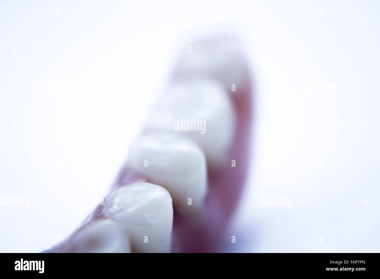 Removable partial denture metal and plastic dental false teeth ...