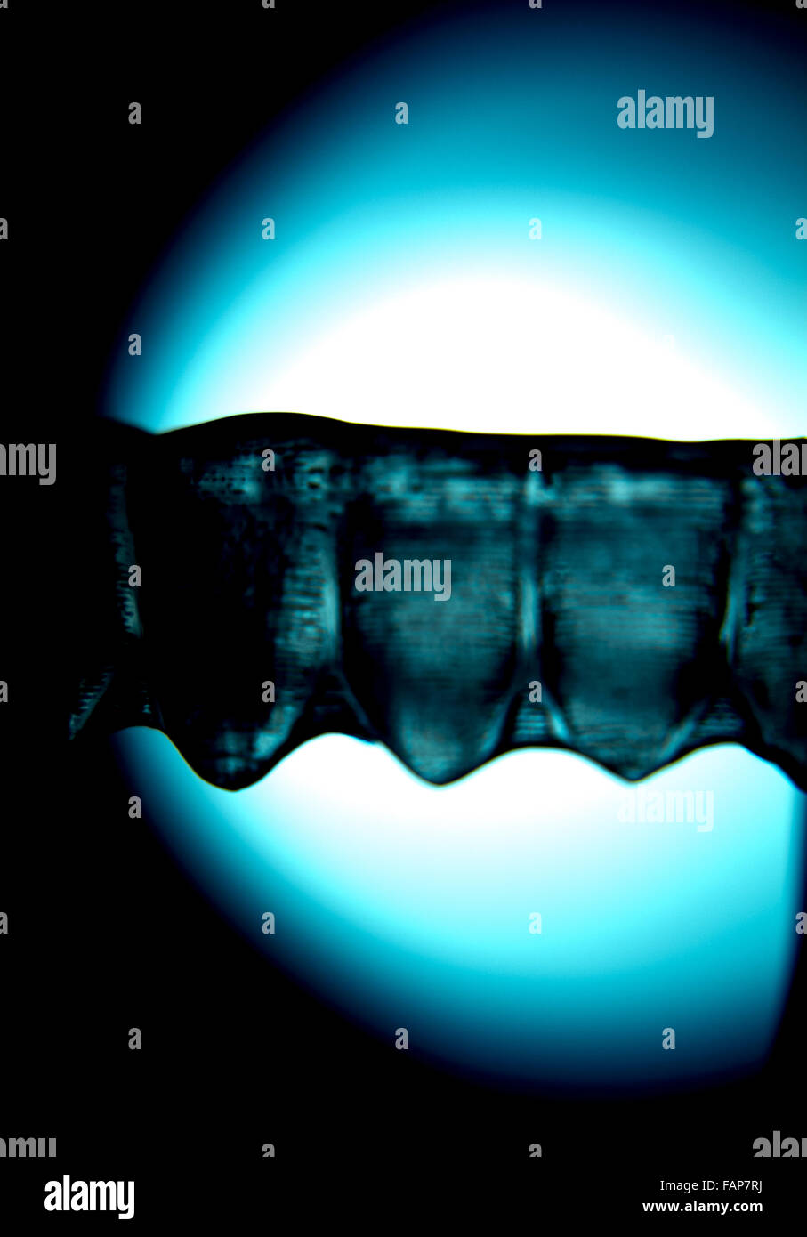 Invisible dental aligners modern tooth brackets transparent teeth ...