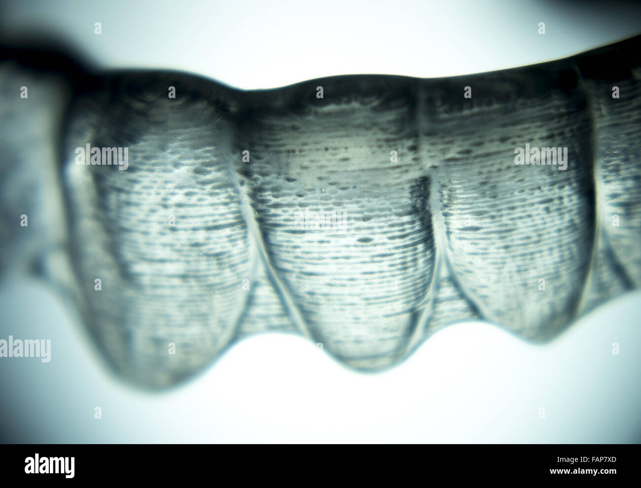 Invisible dental aligners modern tooth brackets transparent teeth ...