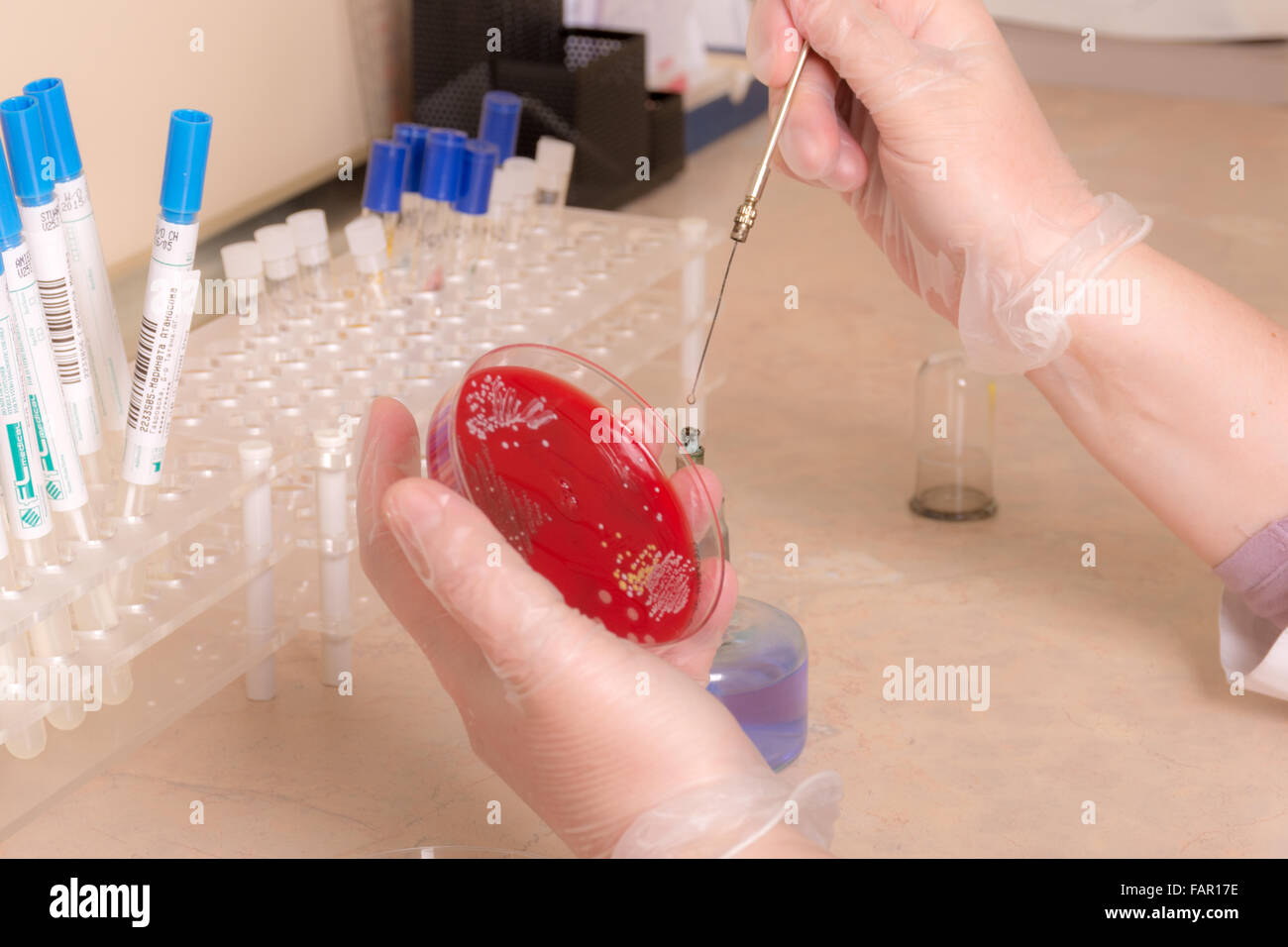 Testing of blood samples for diseases and hormones Stock Photo - Alamy