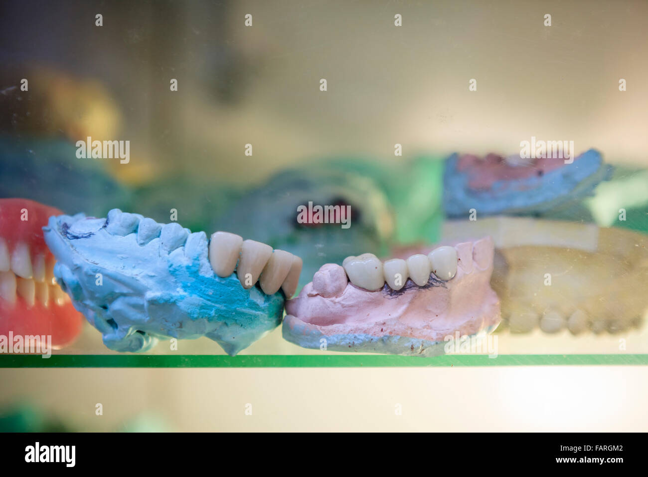 Teeth in dentist's shop-window. Kathmandu. Nepal Stock Photo - Alamy