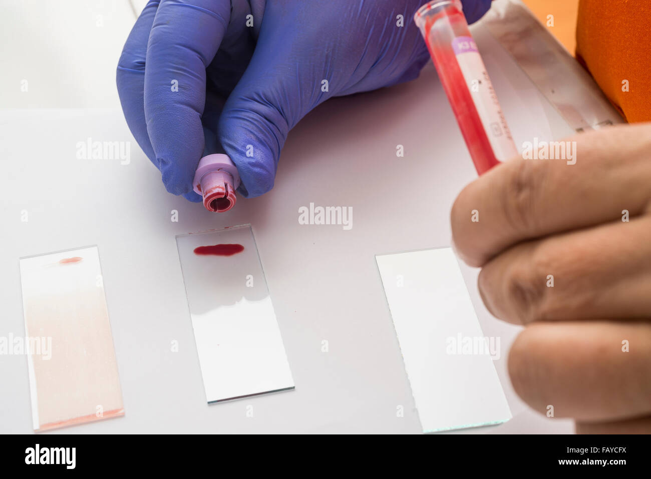 Blood test laboratory hi-res stock photography and images - Alamy