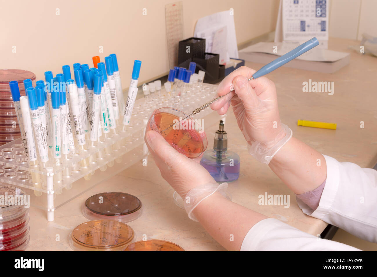 Testing of blood samples for diseases and hormones Stock Photo - Alamy