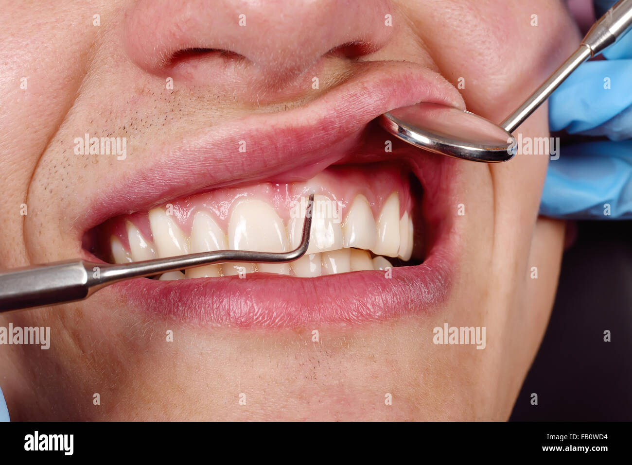 man patient having her teeth examined by specialist Stock Photo - Alamy