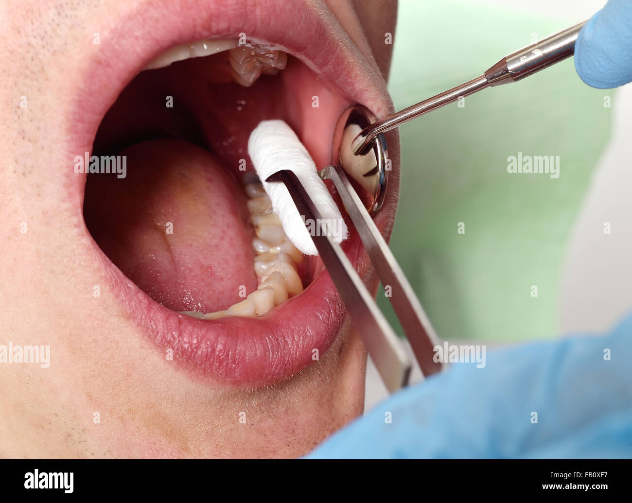 Dentist examination and teeth hi-res stock photography and images - Alamy