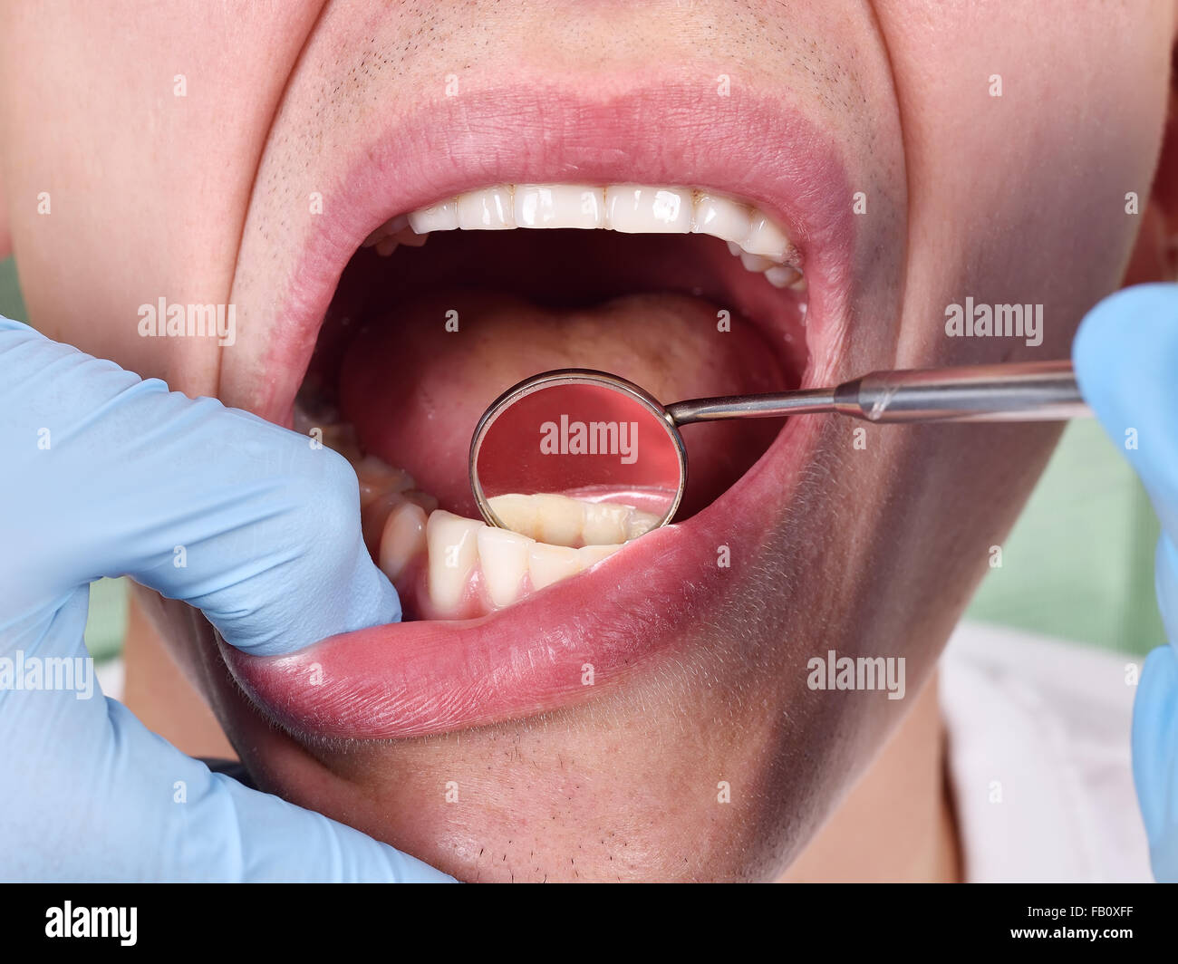 Dentist examining patient's teeth, extra close up Stock Photo - Alamy