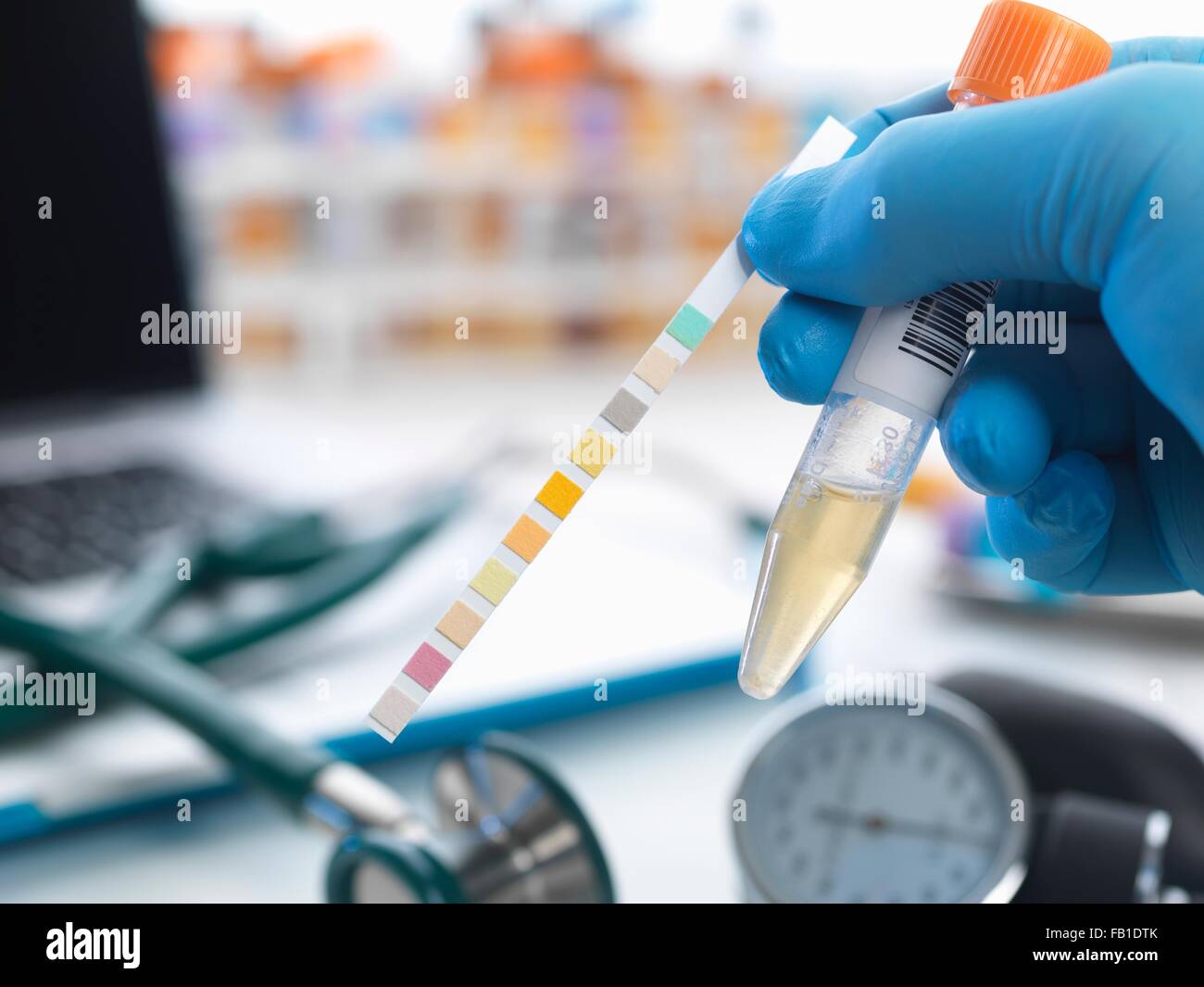 Urine sample with test strip showing results Stock Photo - Alamy