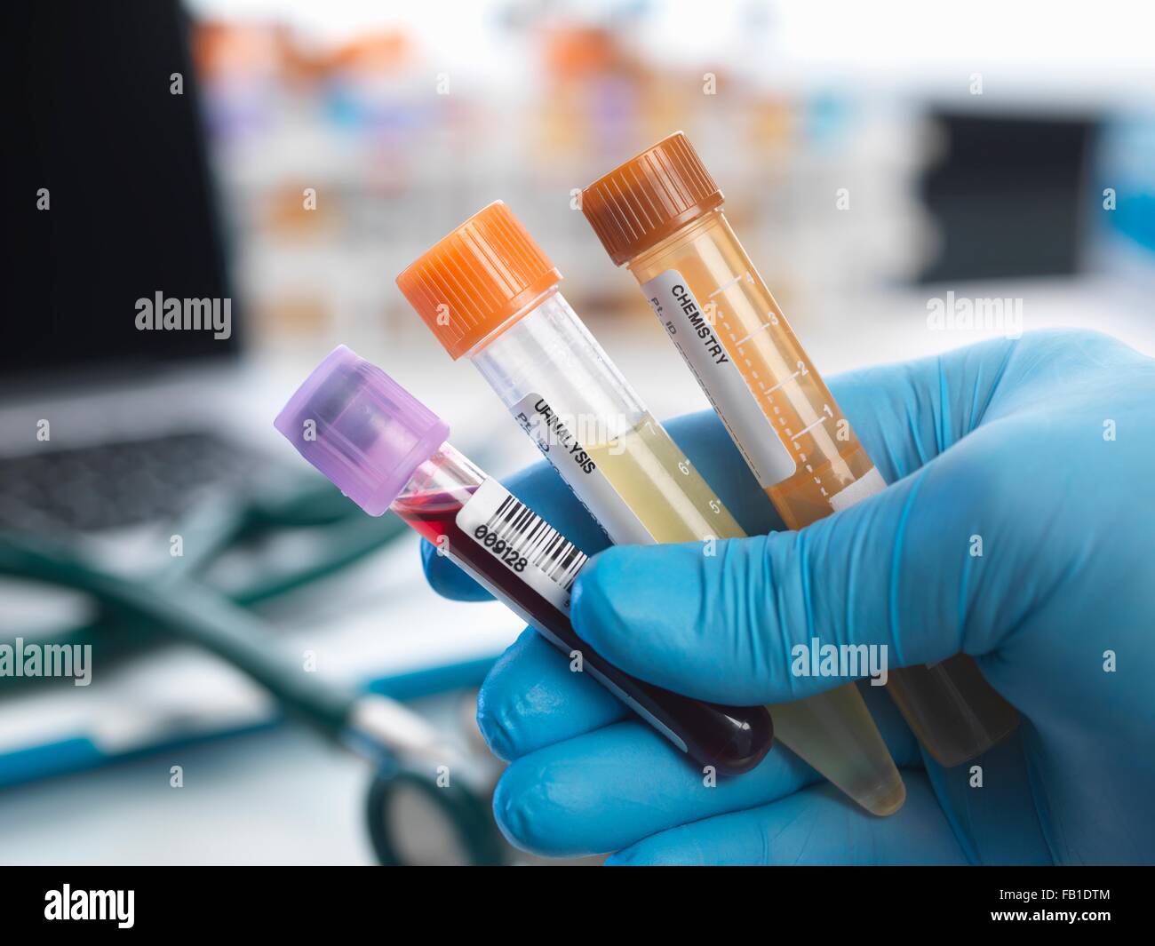 Human samples including blood, urine and chemistry being collected for ...