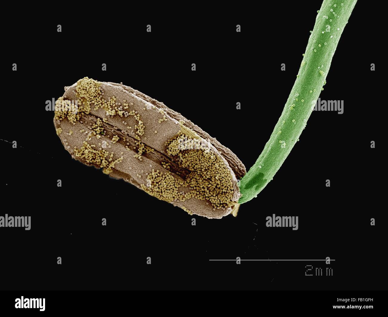 Colorized sem scanning electron microscope hi-res stock photography and ...