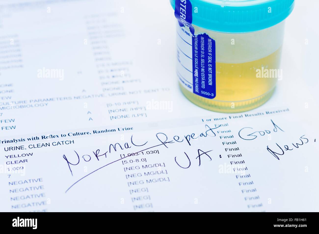 Studio shot of urine sample on test printout showing normal results ...