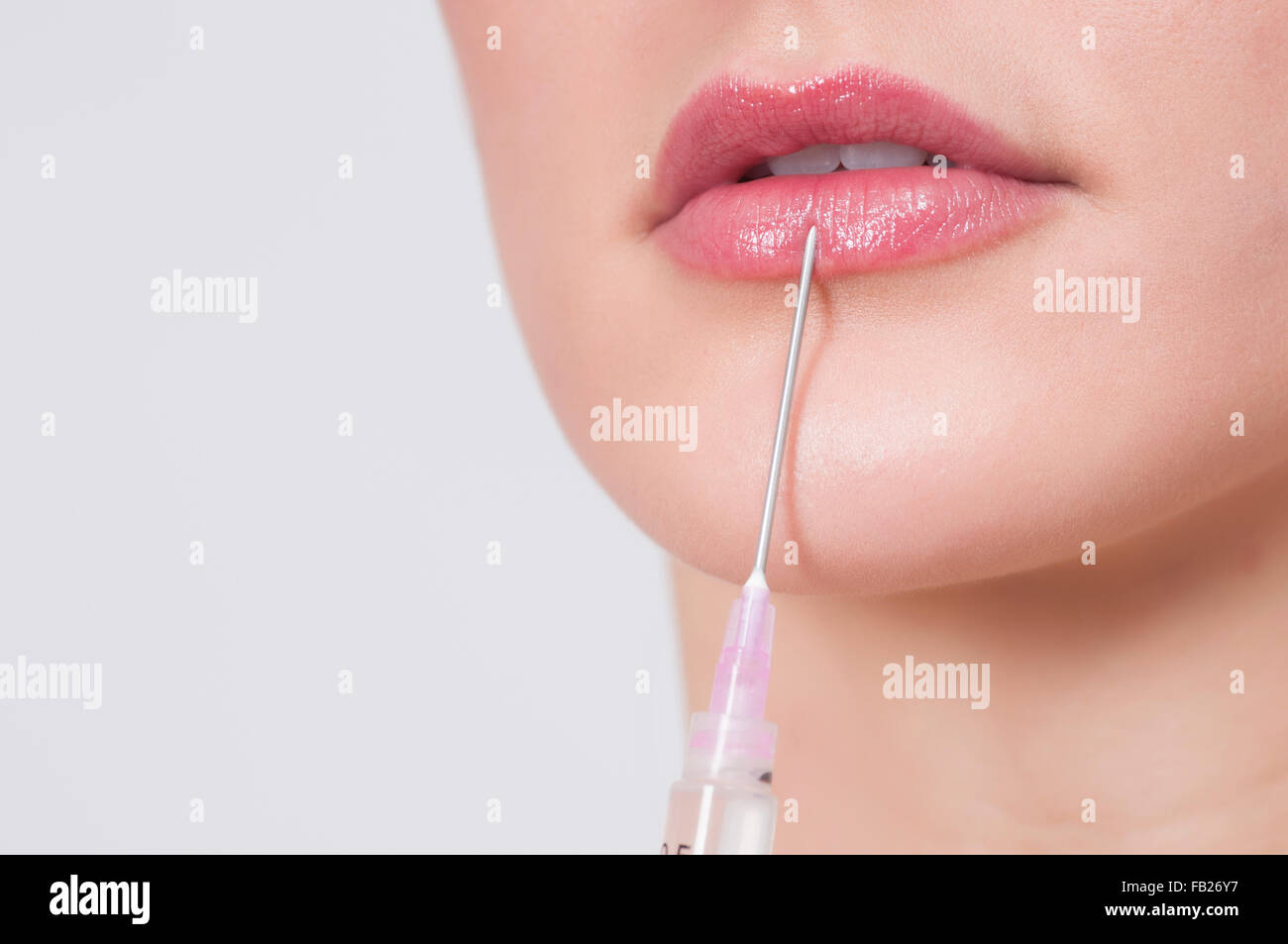 Close up of a young woman receiving a botox injection to her lips Stock ...