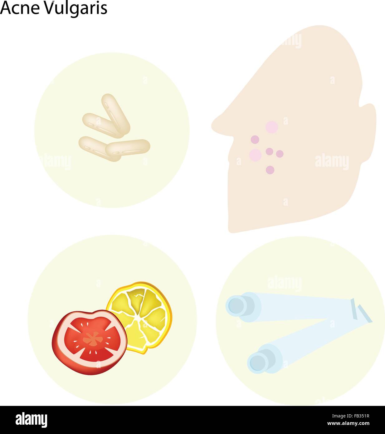 Acne vulgaris hi-res stock photography and images - Alamy