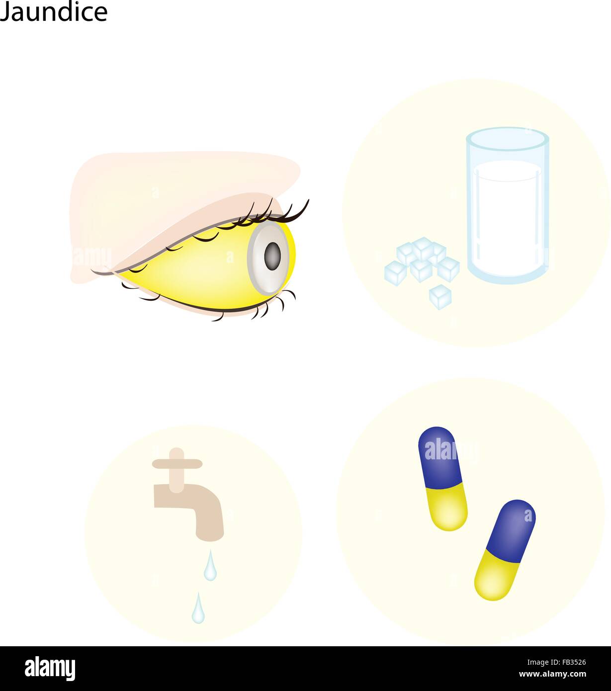 Yellow Jaundice Stock Photos & Yellow Jaundice Stock Images - Alamy