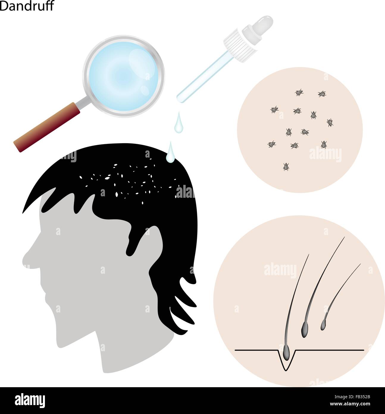 Sebum Secretion High Resolution Stock Photography and Images - Alamy