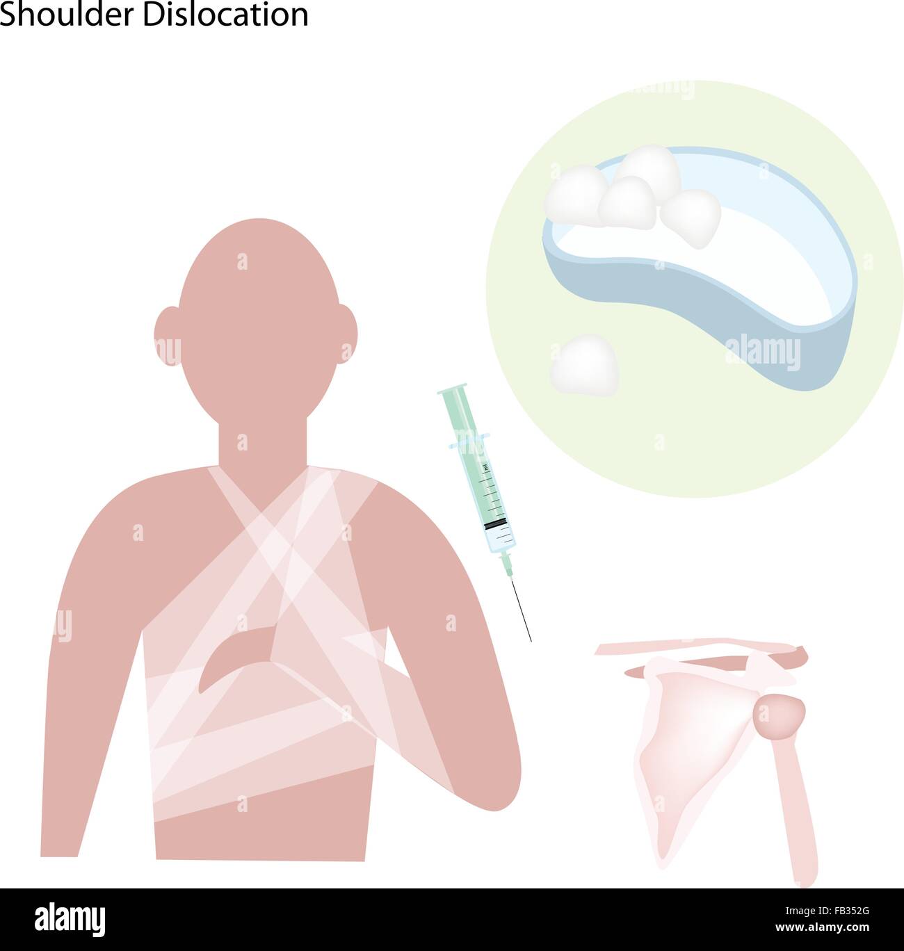 Dislocated shoulder High Resolution Stock Photography and Images - Alamy