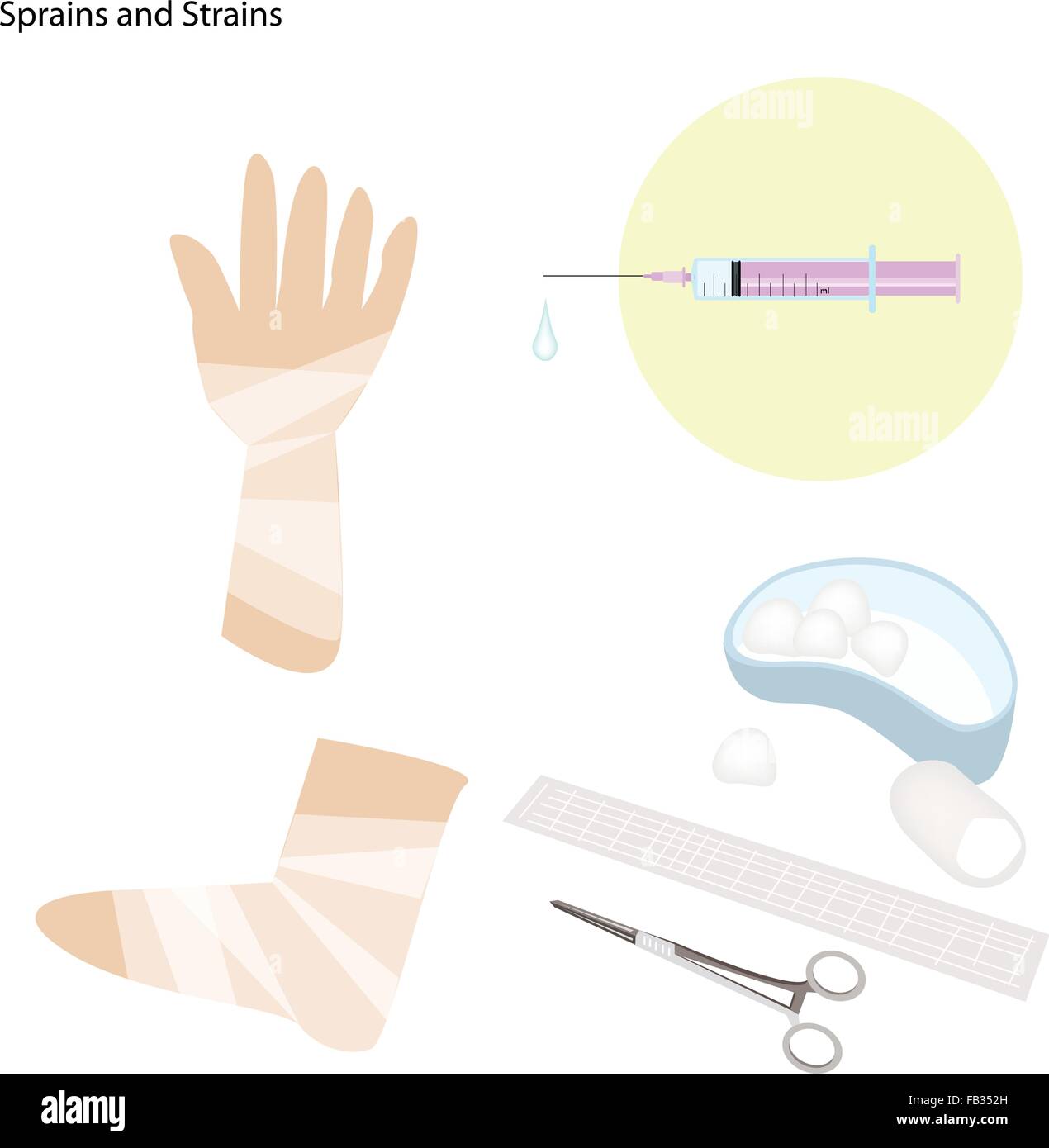 Muscle ligament sprains hi-res stock photography and images - Alamy