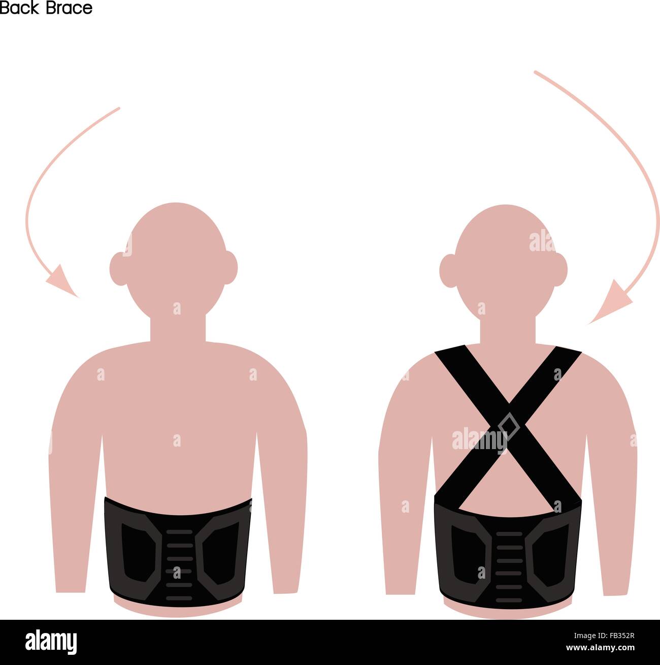 Medical Concept, Illustration of Back Brace or Lumbar Braces Used to ...