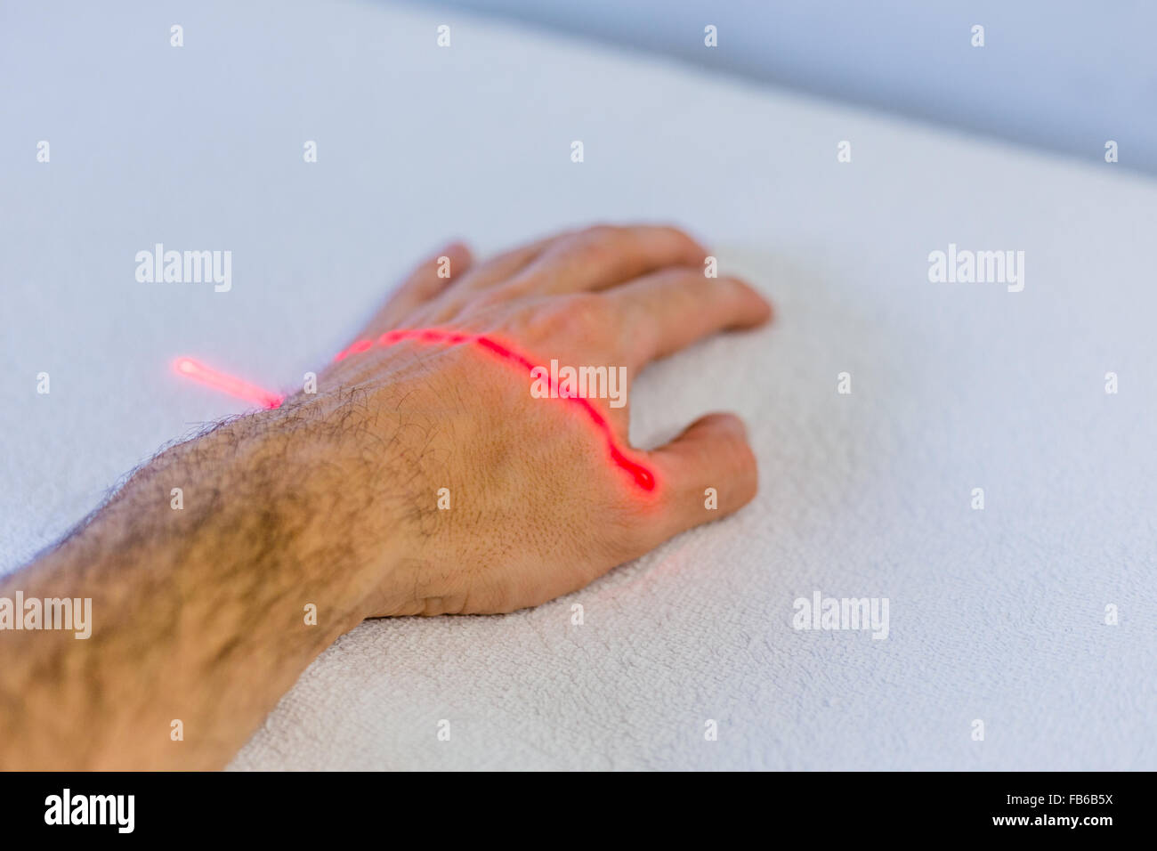 Hands on treatment hi-res stock photography and images - Alamy