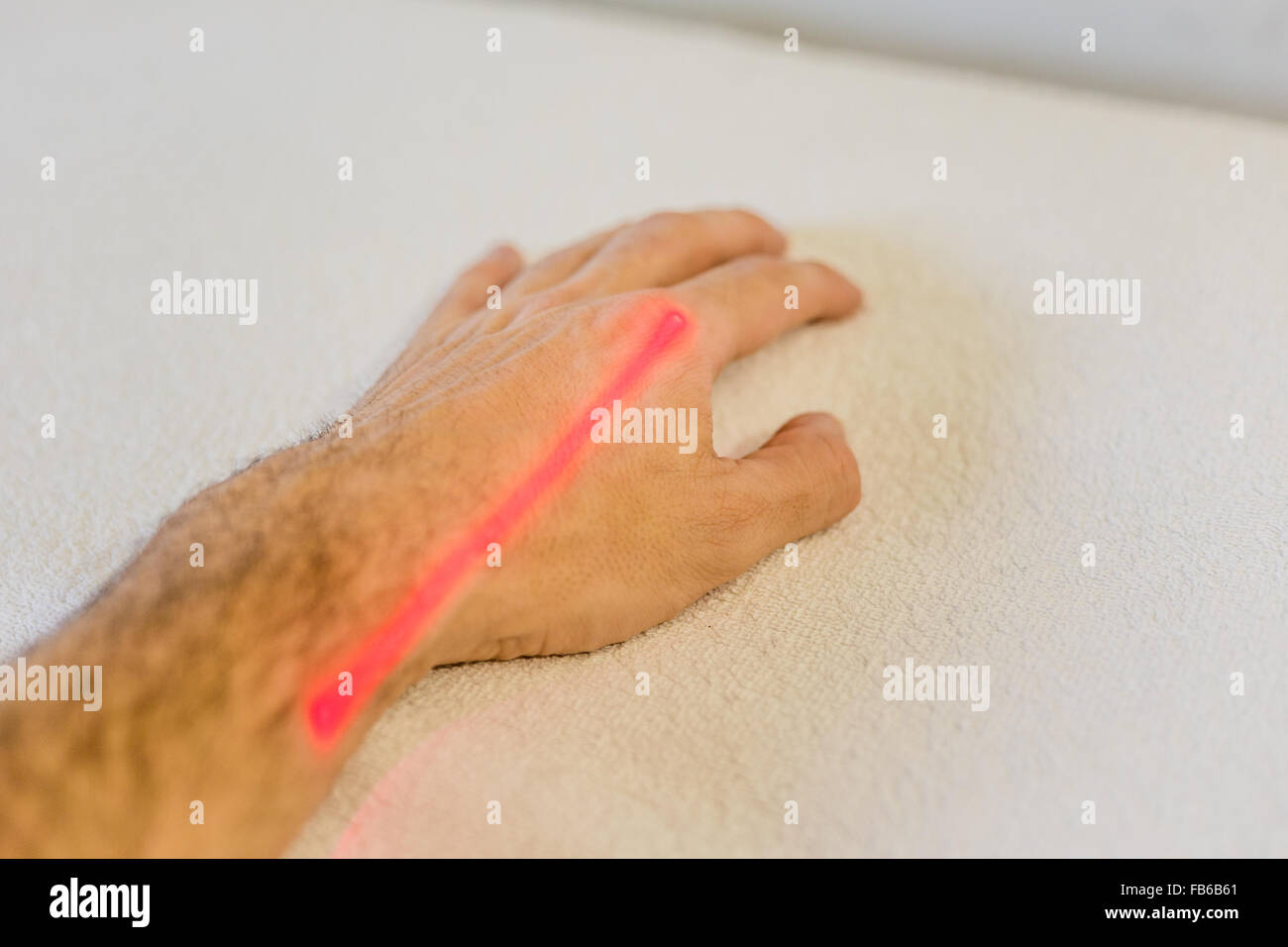 physiotherapy treatment with laser on caucasian hand Stock Photo - Alamy