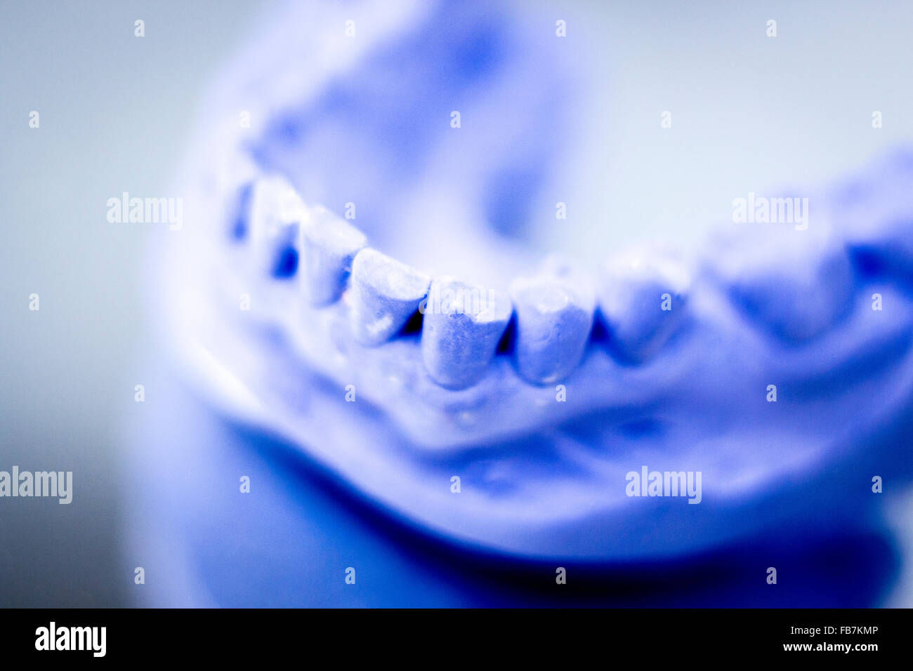 Dental prosthetics clay tooth mold in dentists photo Stock Photo - Alamy