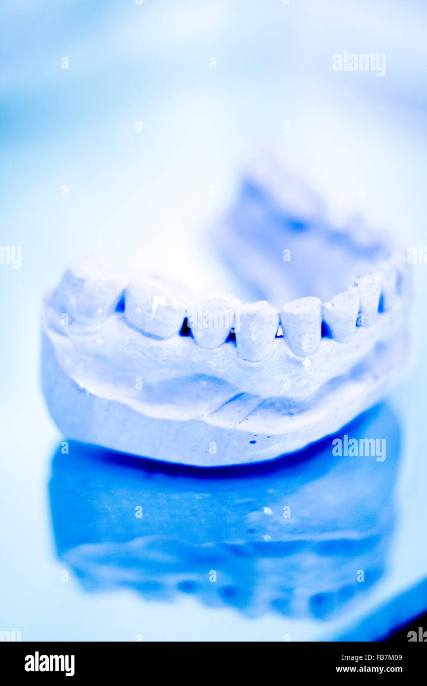 Dental prosthetics clay tooth mold in dentists photo Stock Photo - Alamy