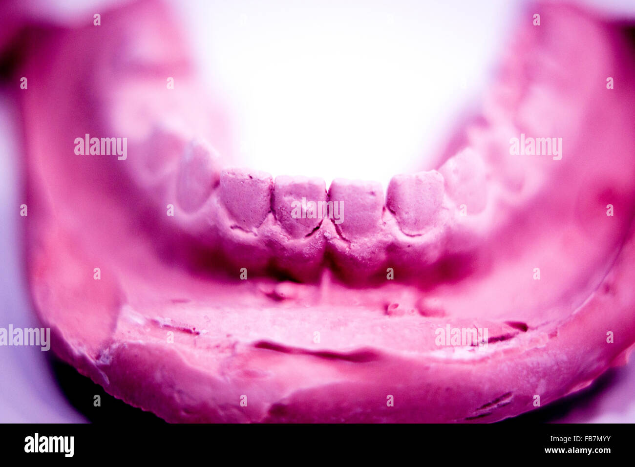 Dental prosthetics clay tooth mold in dentists photo Stock Photo - Alamy