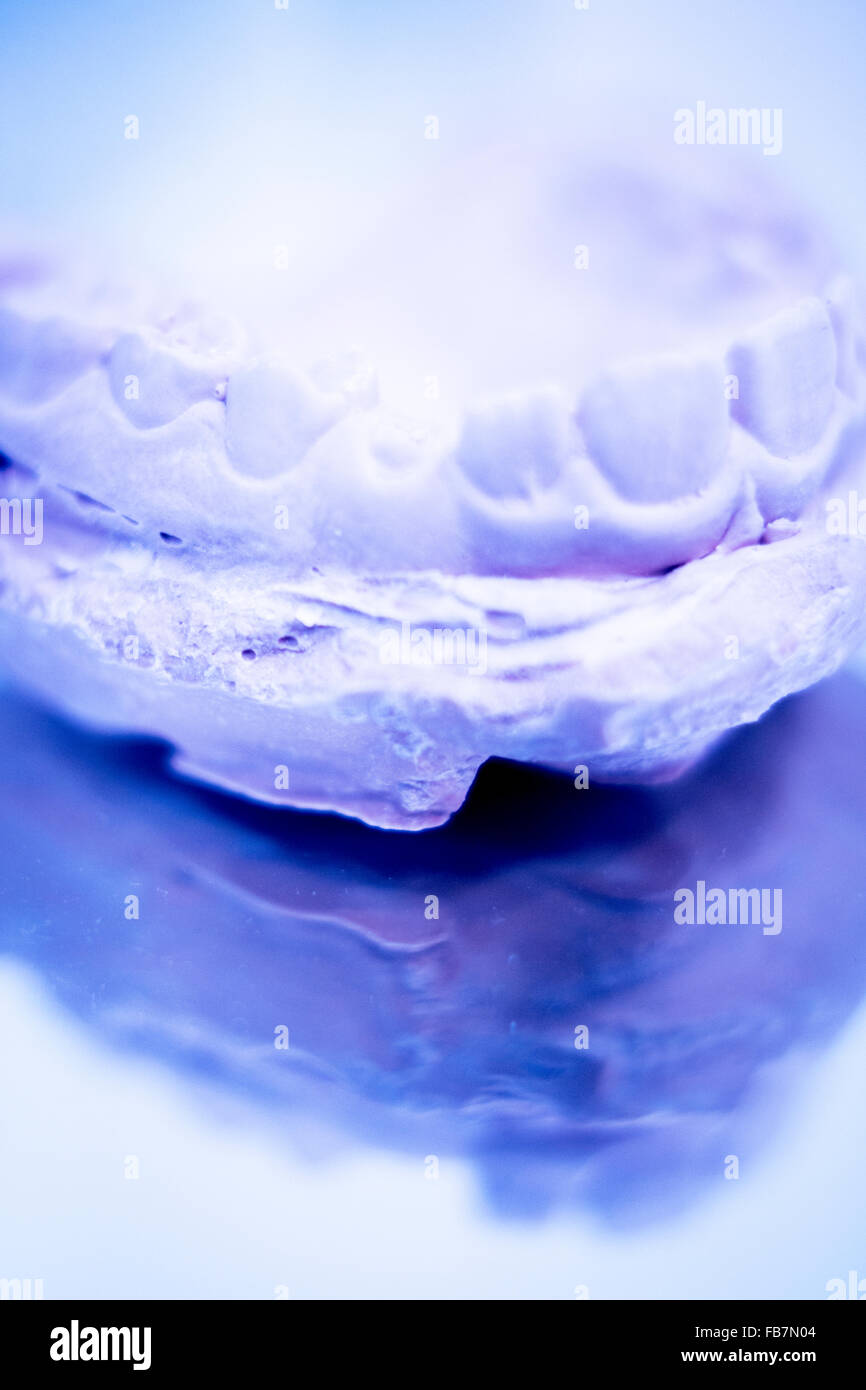 Dental prosthetics clay tooth mold in dentists photo Stock Photo - Alamy