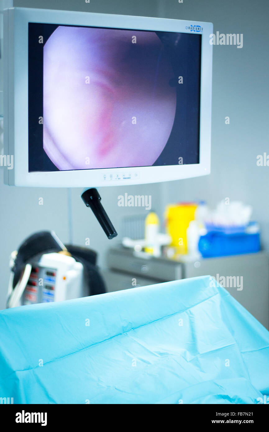 Hospital keyhole micro surgery arthroscopy operation screen showing ...