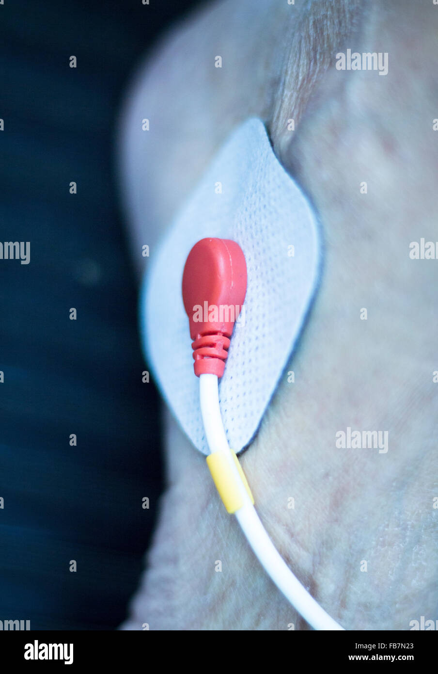 Physiotherapy and orthopedics clinic patient in electrical impulse ...