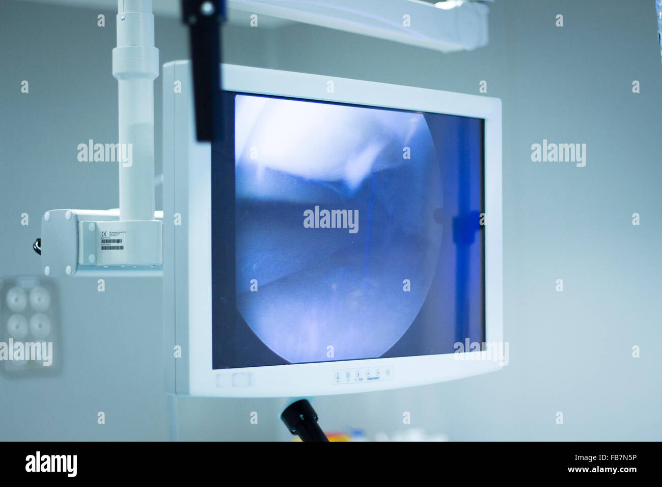 Hospital keyhole micro surgery arthroscopy operation screen showing ...