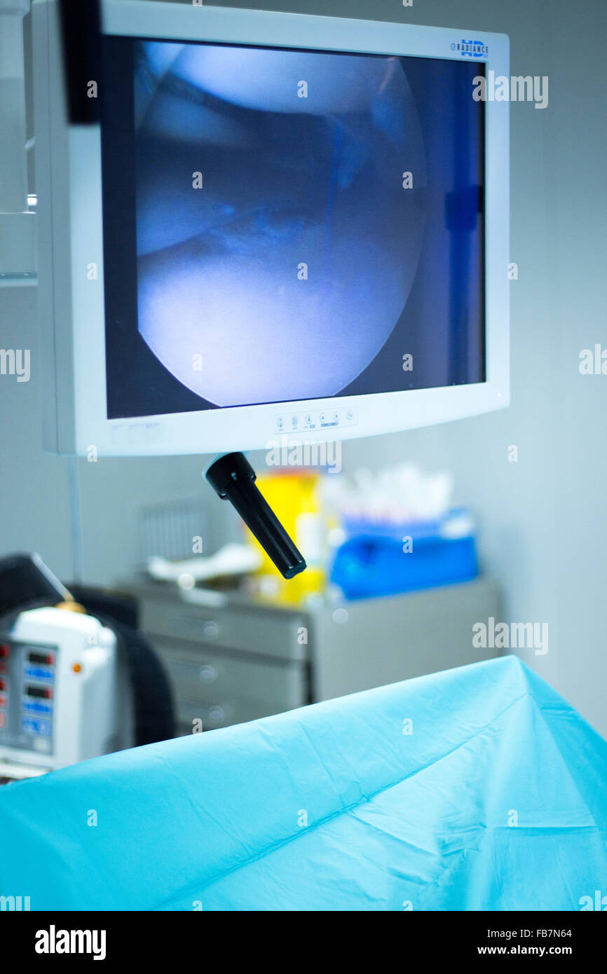 Hospital keyhole micro surgery arthroscopy operation screen showing ...