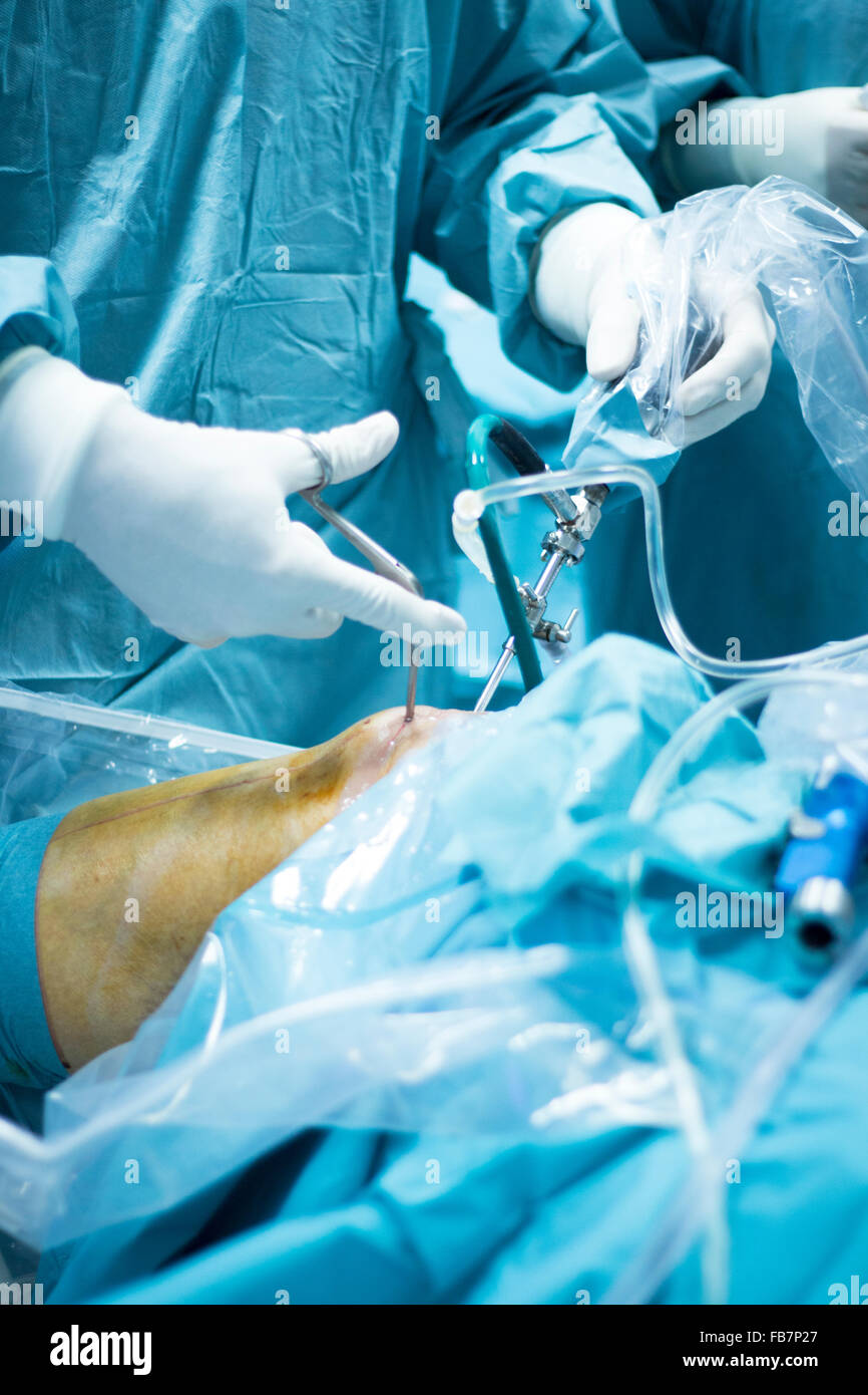 Knee arthroscopy orthopedic surgery operation in hospital operating ...