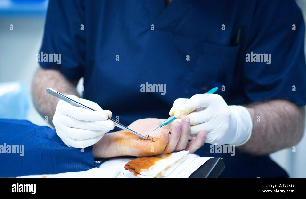 Hospital hand surgery orthopedics operation photo Stock Photo - Alamy