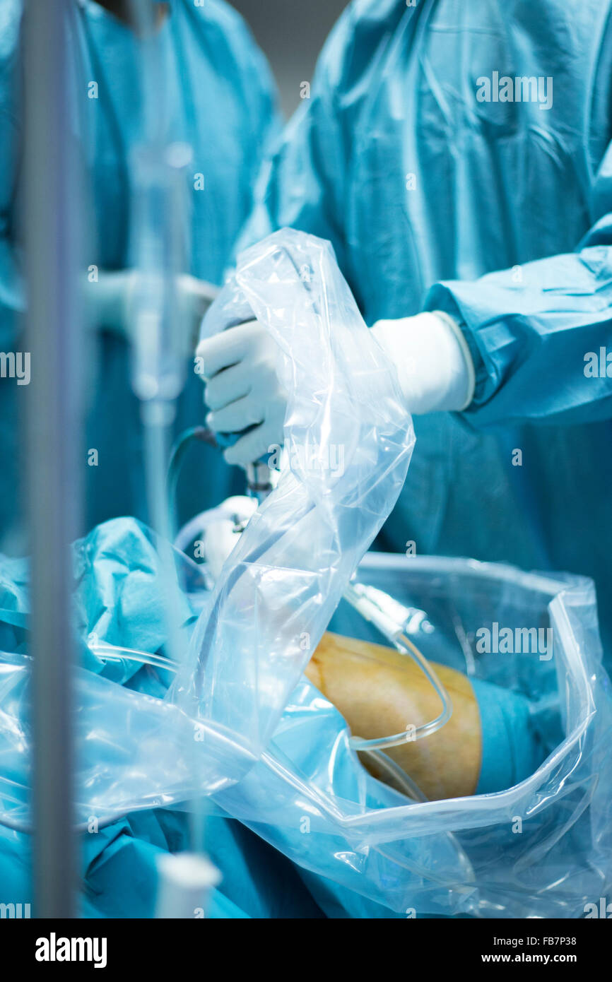 Knee arthroscopy orthopedic surgery operation in hospital emergency ...