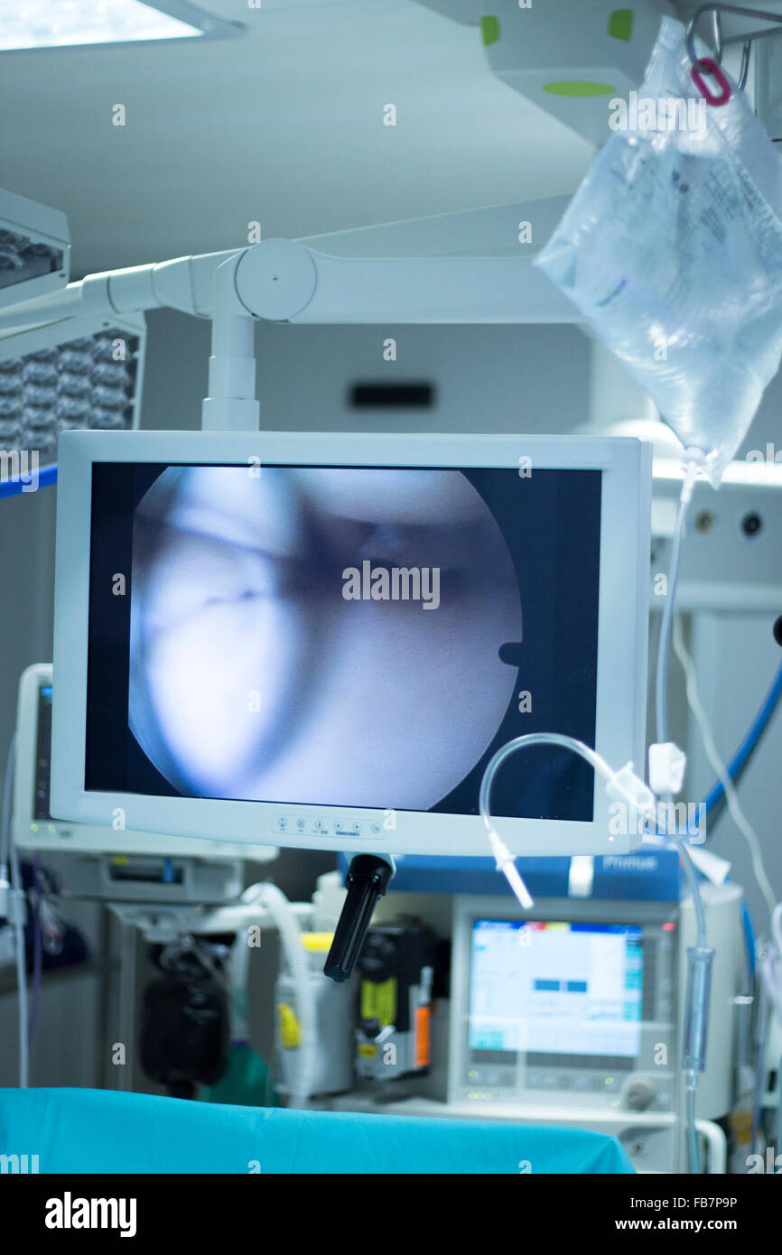 Hospital keyhole micro surgery arthroscopy operation screen showing ...