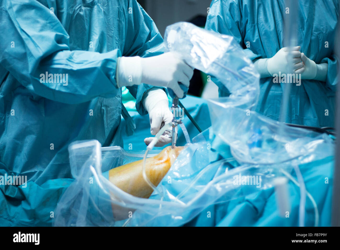 Knee arthroscopy orthopedic surgery operation in hospital operating ...