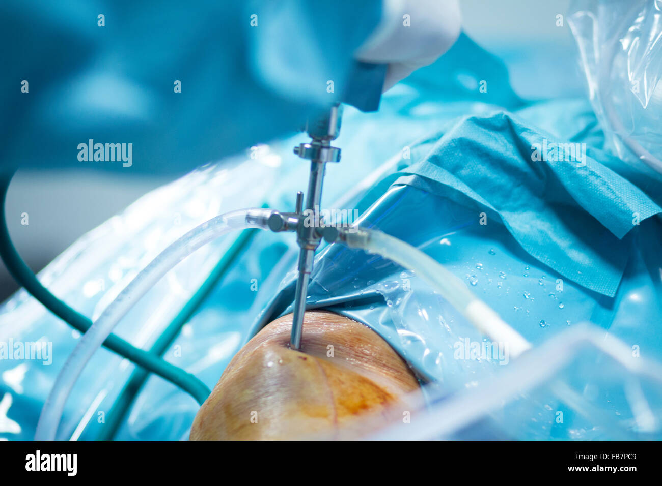 Orthopedics knee surgery Traumatology hospital surgical operation photo ...